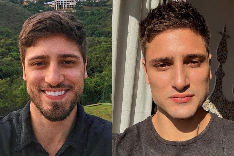 Ator Daniel Rocha passa por cirurgia facial e antes e depois assusta ...
