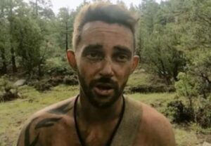 Participante de reality queima partes íntimas e é socorrido por ...