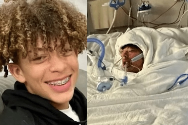 Jovem tiktoker de 16 anos termina com 75% do corpo consumido pelo fogo ...