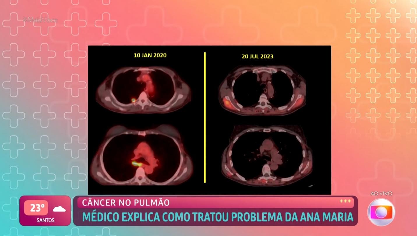 Após luta contra o câncer, Ana Maria Braga leva o próprio médico ao ...