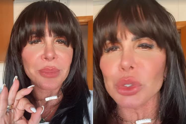 Gretchen se revolta após fã desconfiar de sua cirurgia: "Coisa mais ...