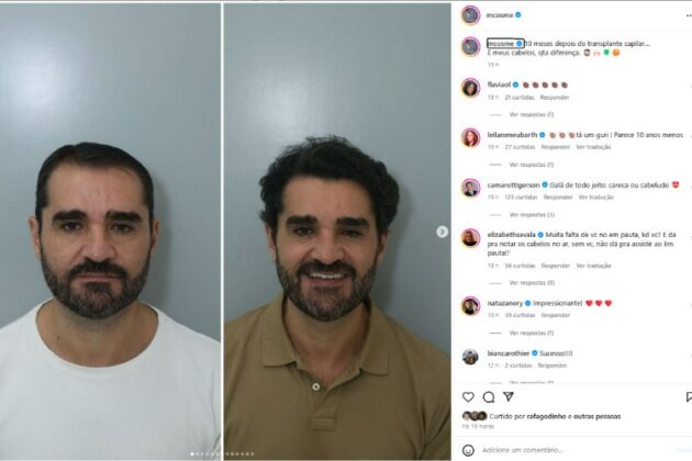 Marcelo Cosme, âncora da GloboNews, surpreende ao mostrar resultado de ...