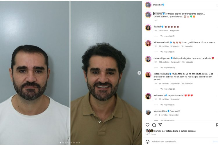 Marcelo Cosme, âncora da GloboNews, surpreende ao mostrar resultado de ...